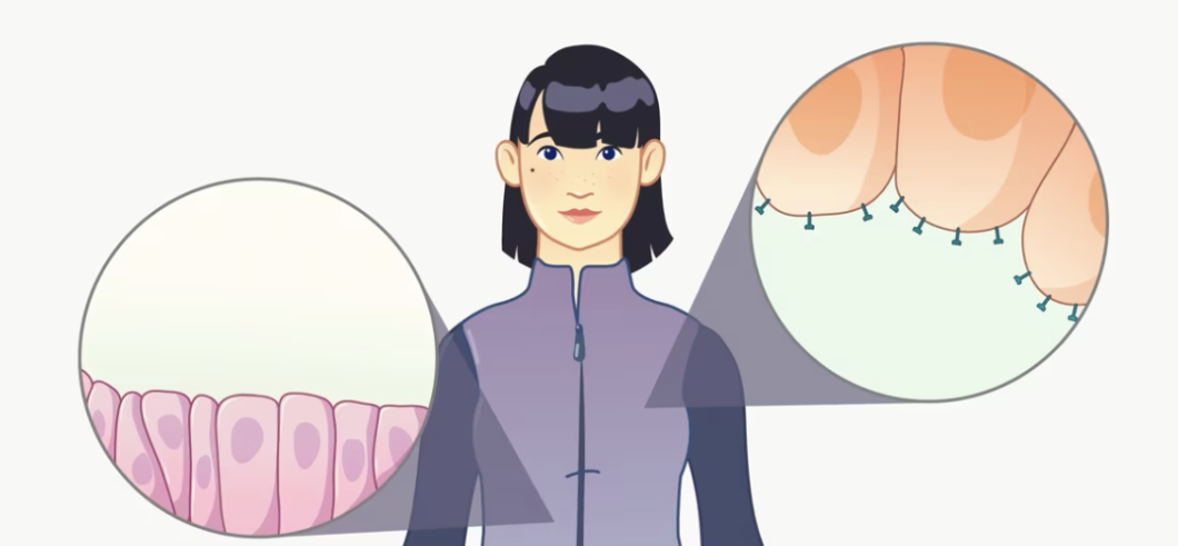 Immune Tolerance | Harvard University