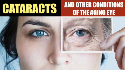Cataracts and Other Conditions of the Aging Eye | Harvard University